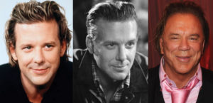 Mickey Rourke Plastic Surgery Before and After Pictures 2025