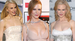 Nicole Kidman Plastic Surgery Before and After Pictures 2025