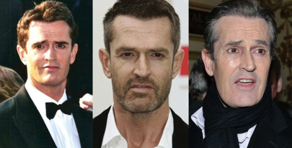 Rupert Everett Plastic Surgery Before and After Pictures 2025